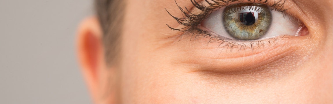 How To Get Rid Of Wrinkles & Fine Lines | Exuviance®